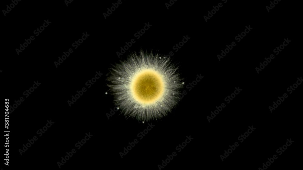 Cyanobacteria Gloeotrichia under the microscope, Order Nostocales ...