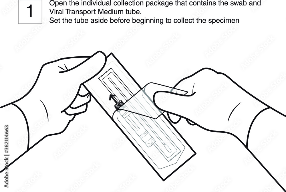 Open the individual collection package that contains the swab and Viral ...