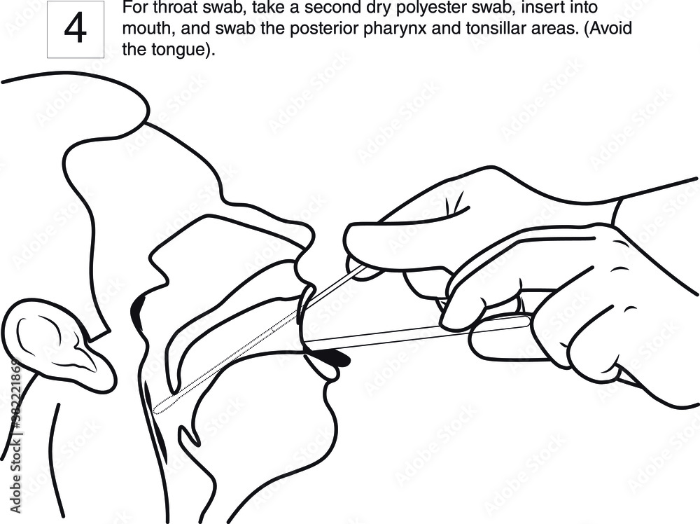 step 4 : For throat swab, take a second dry polyester swab, insert into ...