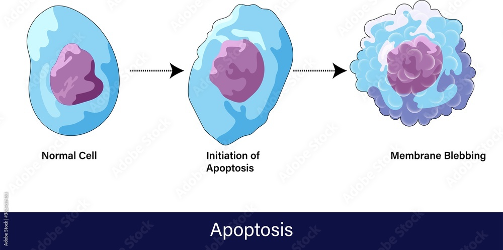 Stages of apoptosis from normal cell to final stage of formation of ...