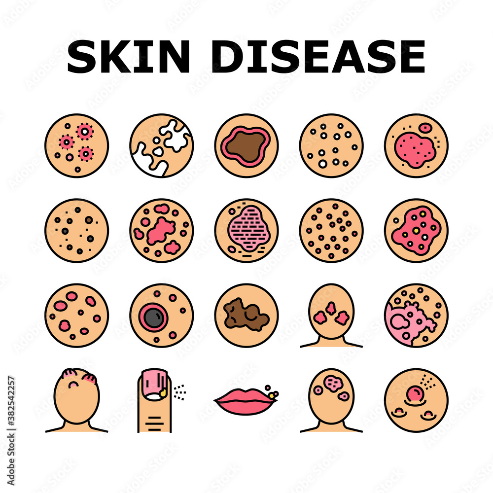 Skin Disease Symptom Collection Icons Set Vector. Skin Cancer And Acne ...