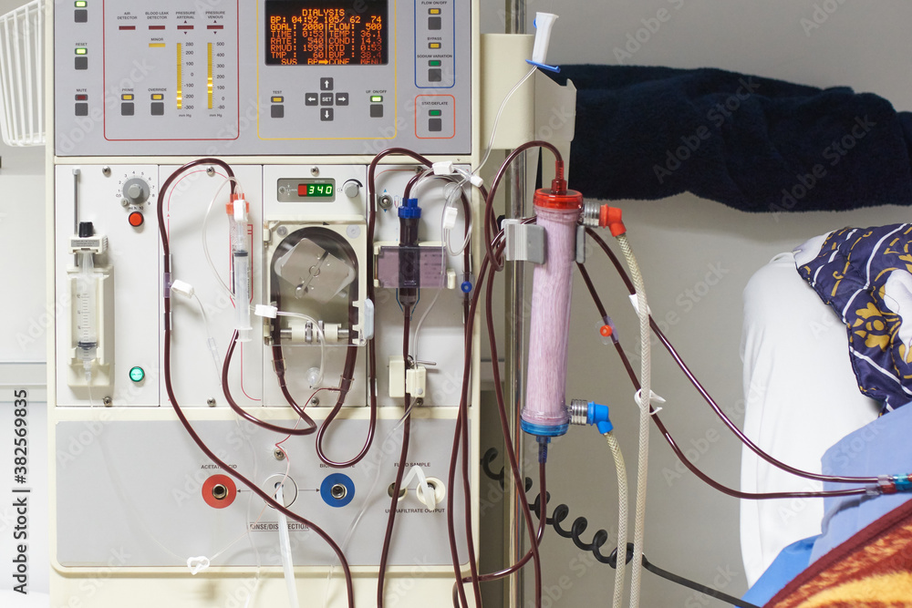 Hemodialysis machine in a hospital Stock Photo | Adobe Stock