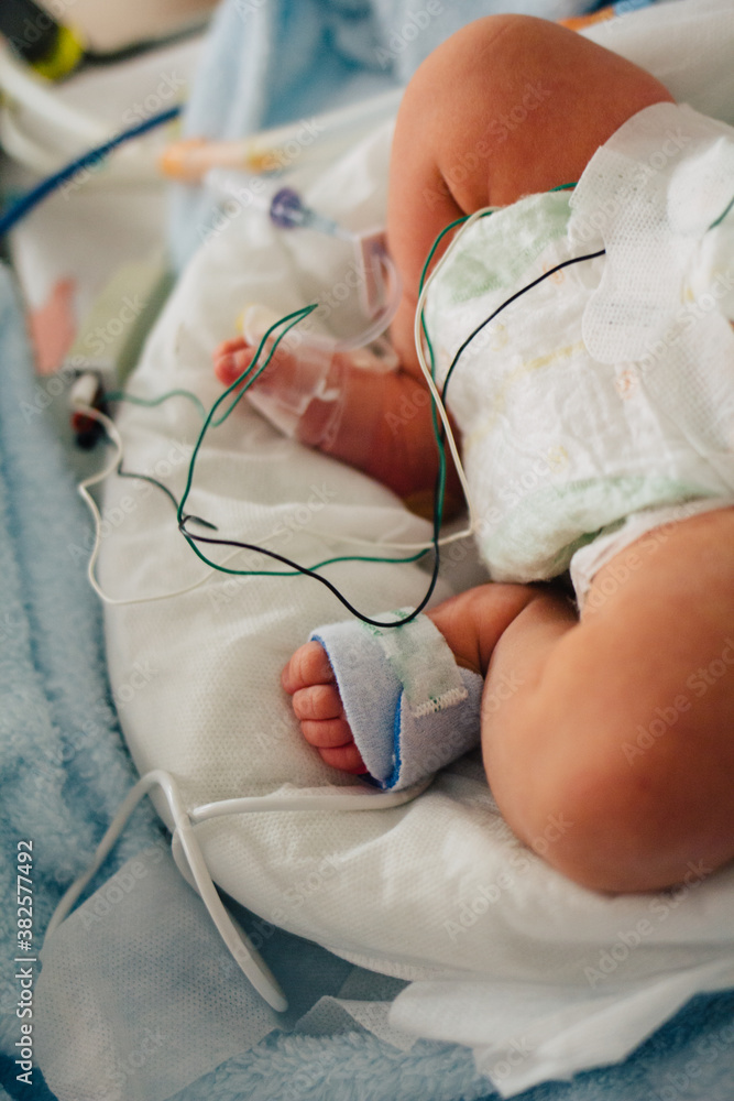 Newborn baby boy in an isolette in a neonatal intensive care unit ...