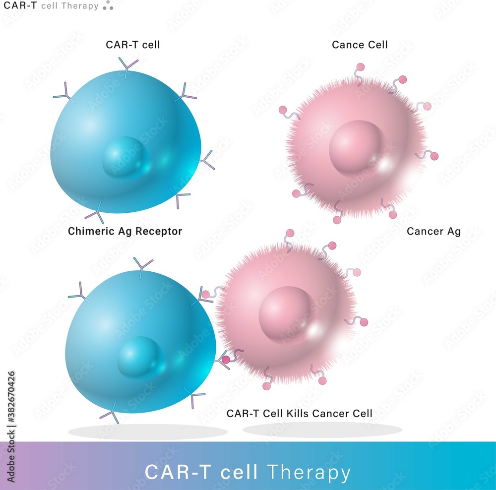 CAR t cell therapy. Chimeric receptors are proteins that have been ...