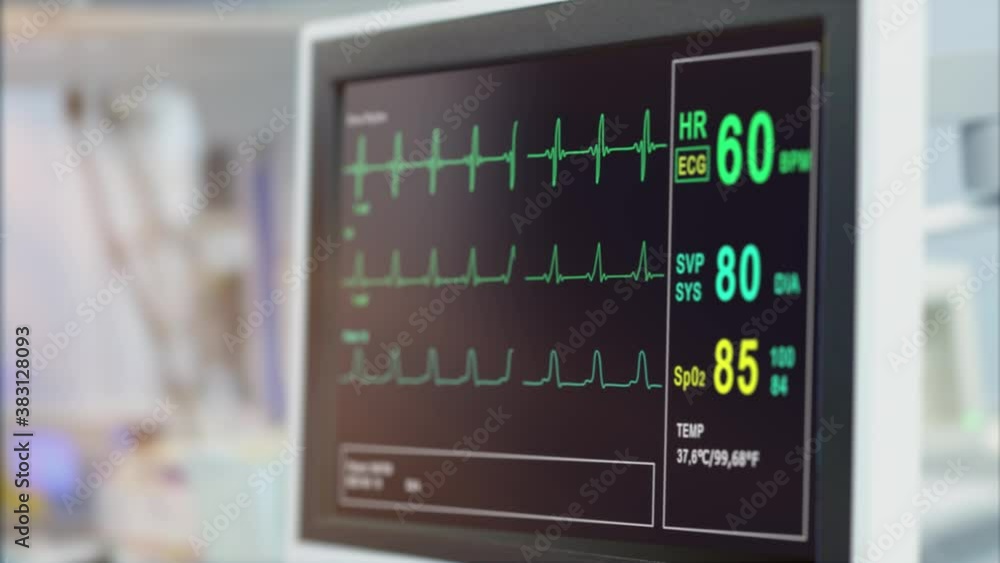 Heart rate monitor in hospital theater. Medical vital signs monitor ...