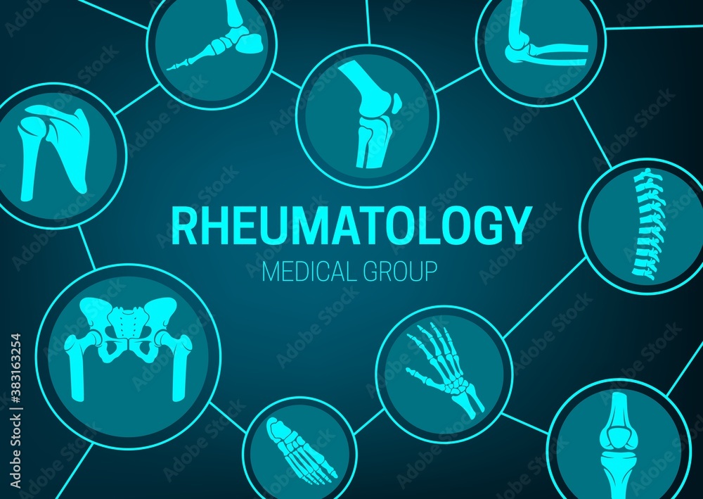 Rheumatology medicine, joint diseases treatment and x-ray banner. Human ...