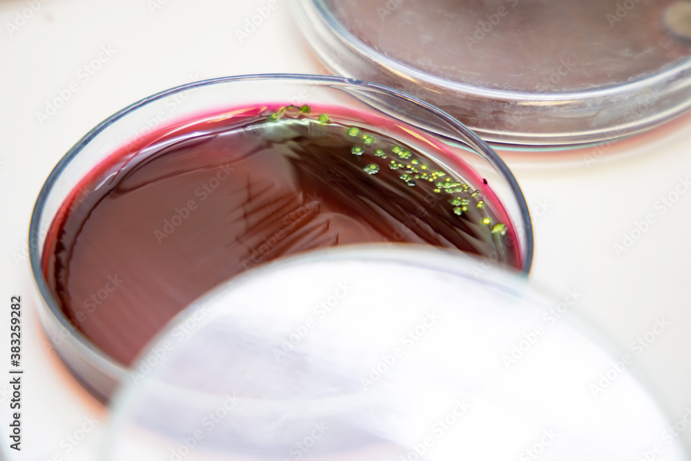 Colse-up Escherichia coli (E. coli) culture in petri dish with ...