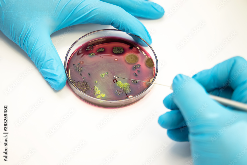 Doctor picking up colony of a red bacteria (Escherichia coli) from agar ...