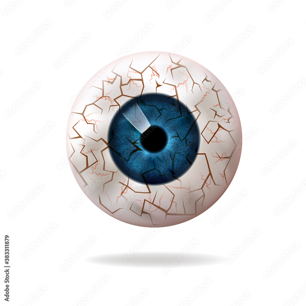Eye diseases, dry, inflamed eyeball, vector. Stock Vector | Adobe Stock