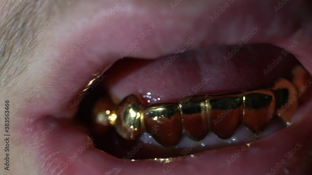 Golden Grillz in a male mouth, gold teeth, lips, left to right movement ...