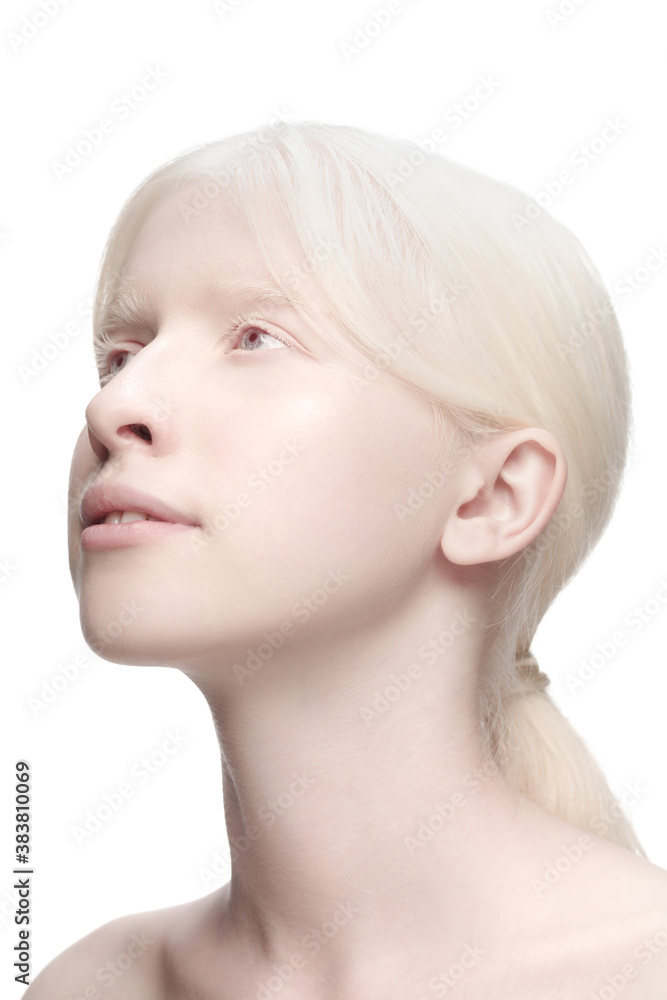 Unique. Portrait of beautiful albino woman isolated on white studio ...