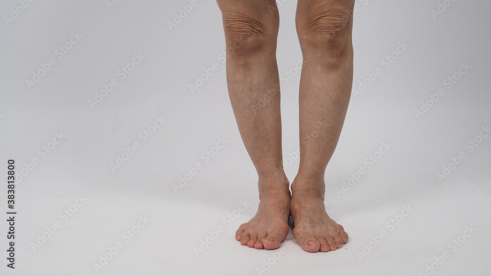 Senior or older woman legs with barefoot standing on white background ...