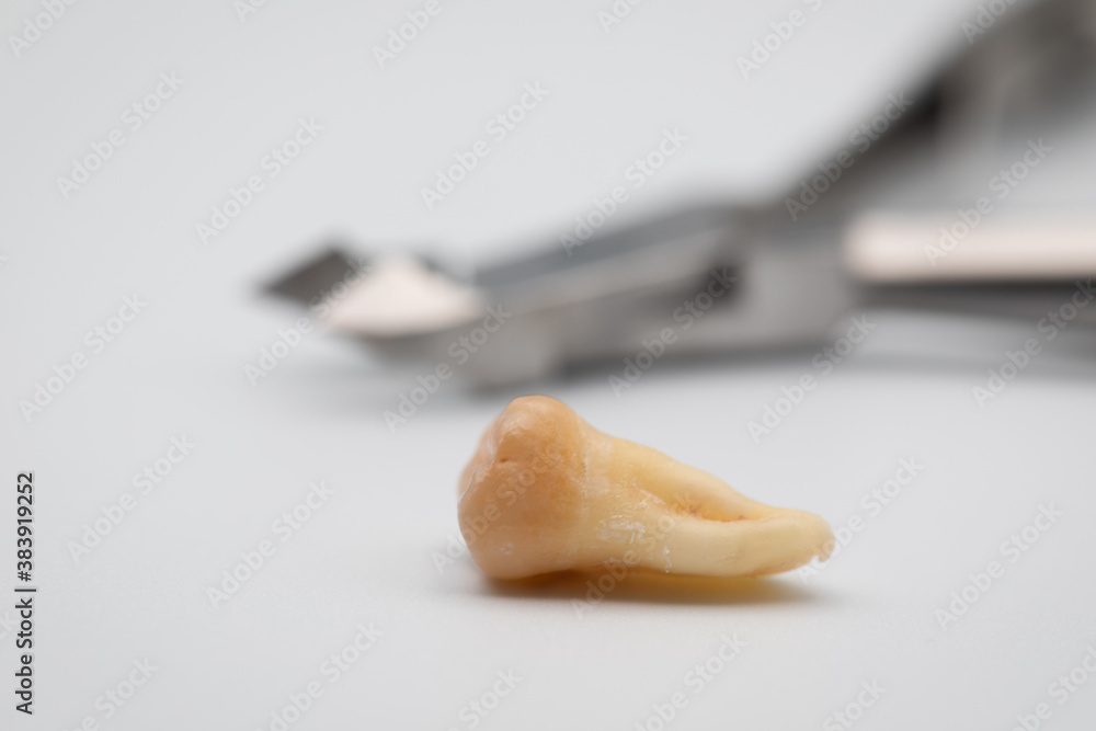 real wisdom tooth. Dental instruments for removing the tooth on the ...