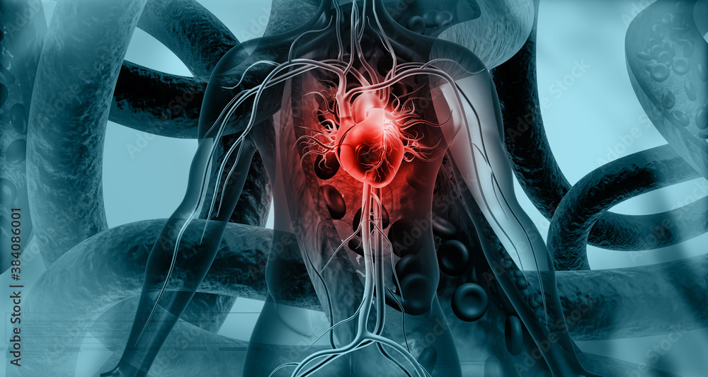 Human heart attack concept. 3d illustration. Stock Illustration | Adobe ...