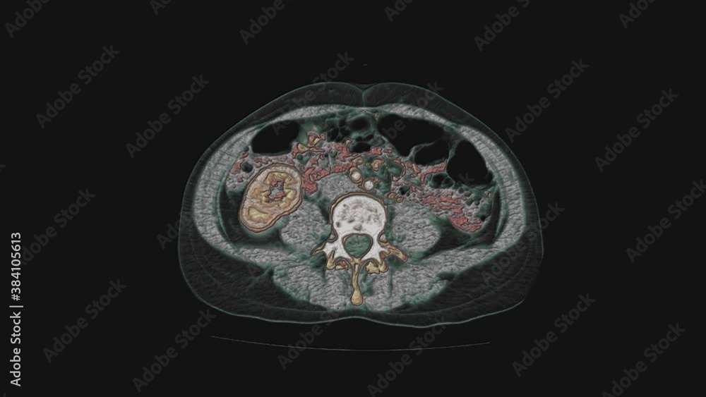 Bulk multicolored MRI of the female pelvic organs, abdominal cavity ...