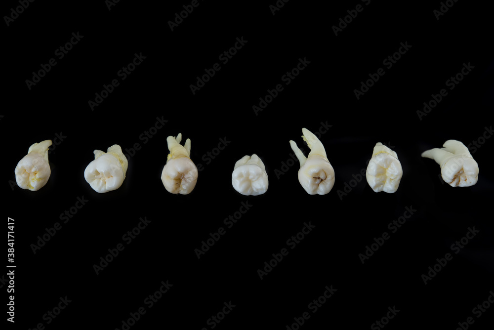 Torn diseased human teeth stacked in a row isolated on black background ...