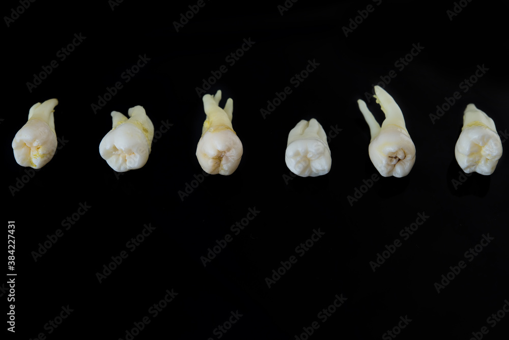 Torn diseased human teeth stacked in a row isolated on black background ...