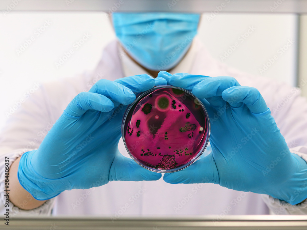 Scientist analysis Escherichia coli (E.coli) culture with Eosin ...