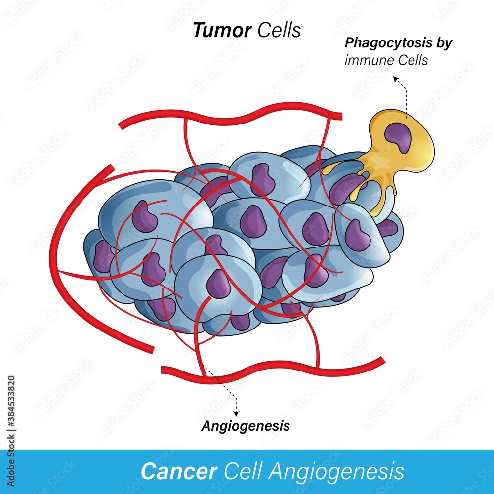 Supply of oxygen and nutrients to tumor/cancer cells lead to ...
