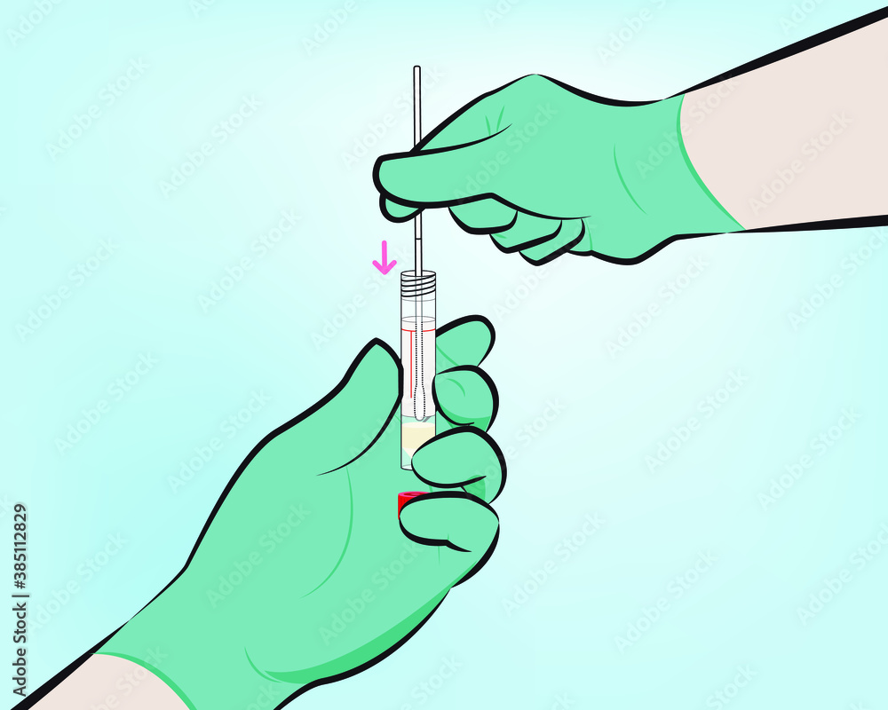 Step 6 : While holding the swab in the same hand, aseptically remove ...