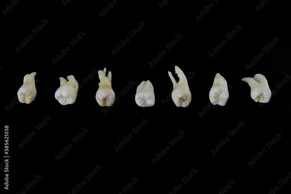 Torn diseased human teeth stacked in a row isolated on black background ...