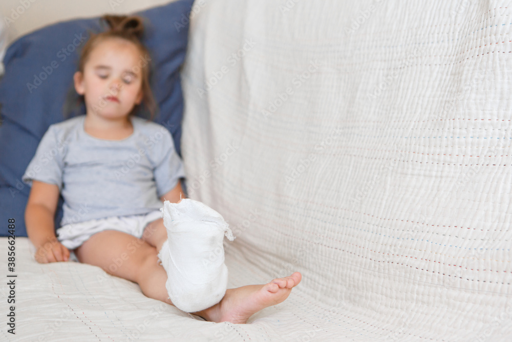 broken leg. Close-up of the cast on the feet. exercises to repair and ...