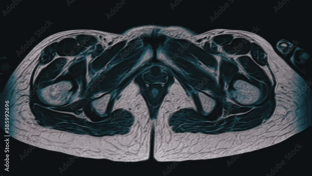Voluminous color MRI of the female pelvic organs, abdominal cavity ...