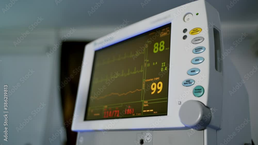 Diagrams of ECG screen. Electrocardiograph machine displays graphics of ...