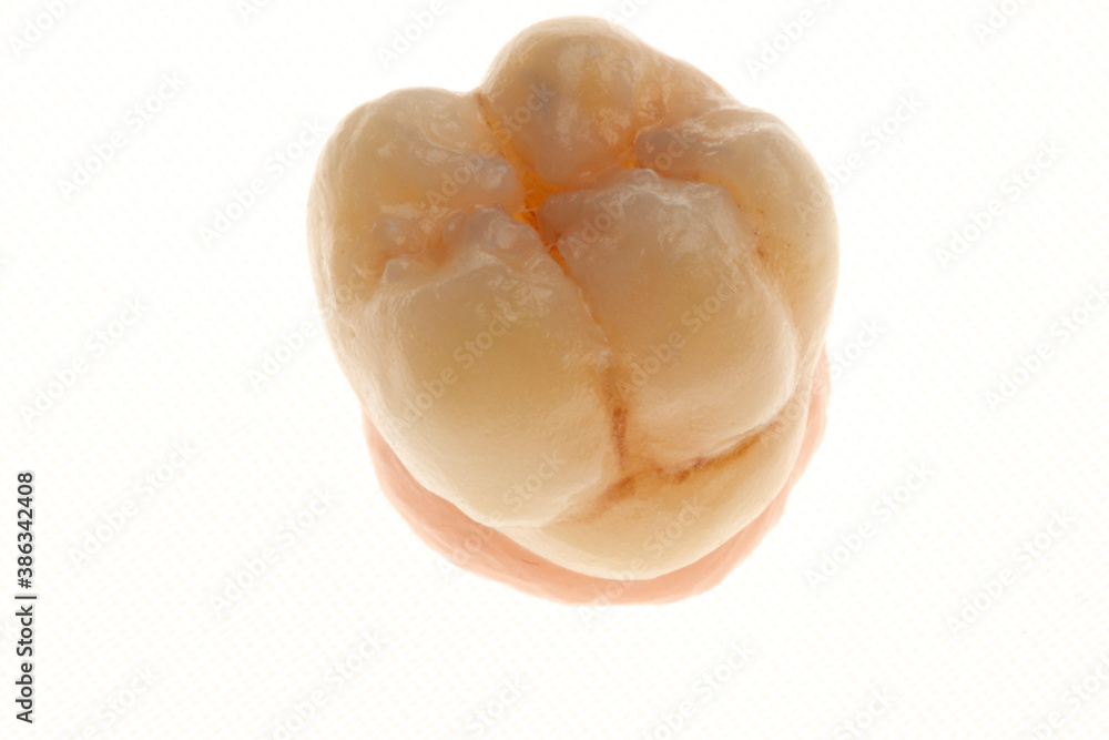porcelain tooth, teeth, tooth, dental porcelain, dentistry ...