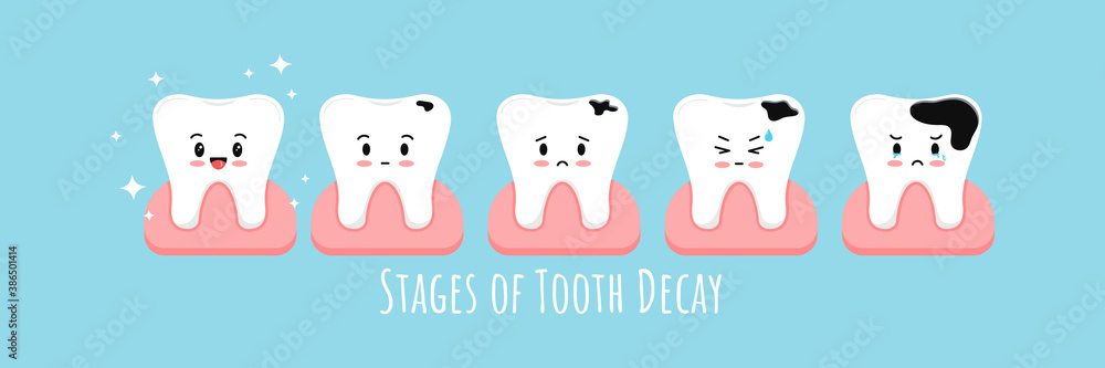 Stages of tooth decay in gum icon set. Cute kawaii teeth on different ...