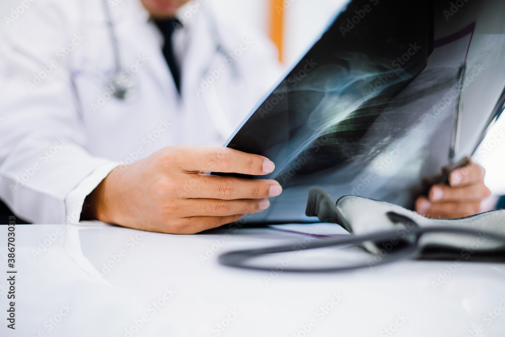 Radiology doctor examining at chest x ray film of patient at health ...