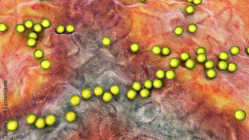 Gram-positive bacteria Streptococcus pyogenes Stock Illustration ...
