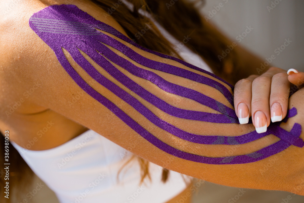 Sporty girl with kinesio tape on her arm. Fixation of the muscles of ...