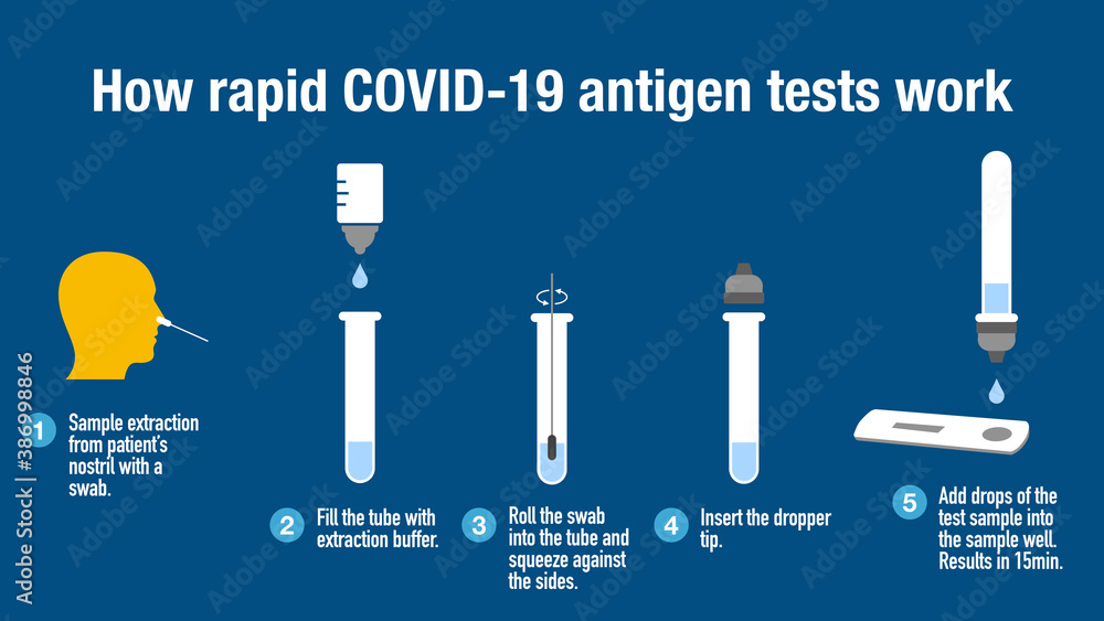 How rapid COVID-19 antigen tests work Stock Illustration | Adobe Stock