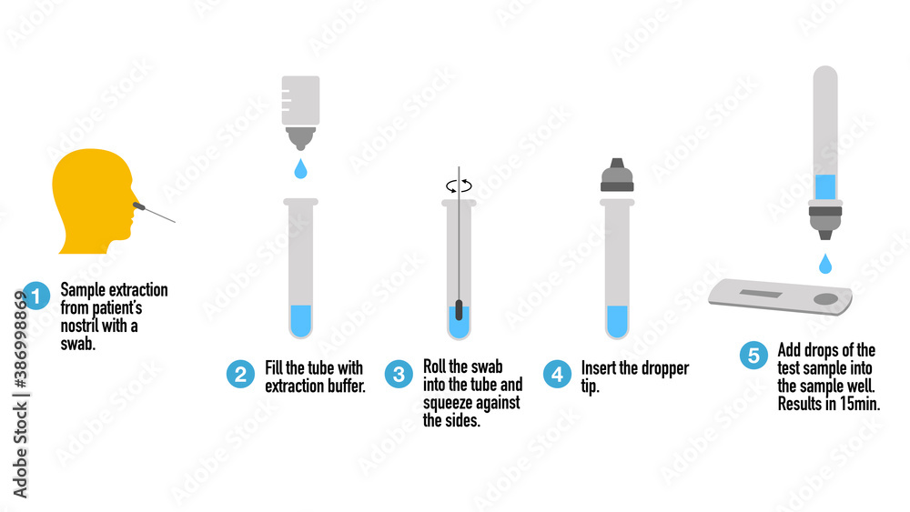 How rapid COVID-19 antigen tests work Stock Illustration | Adobe Stock