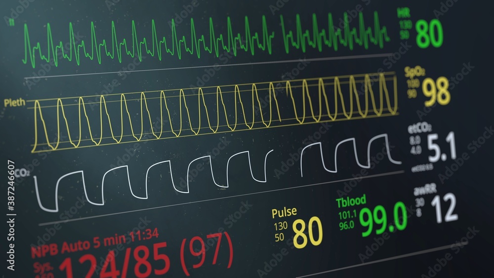 Vital signs of the patient as heart rate, oxygen saturation and ...