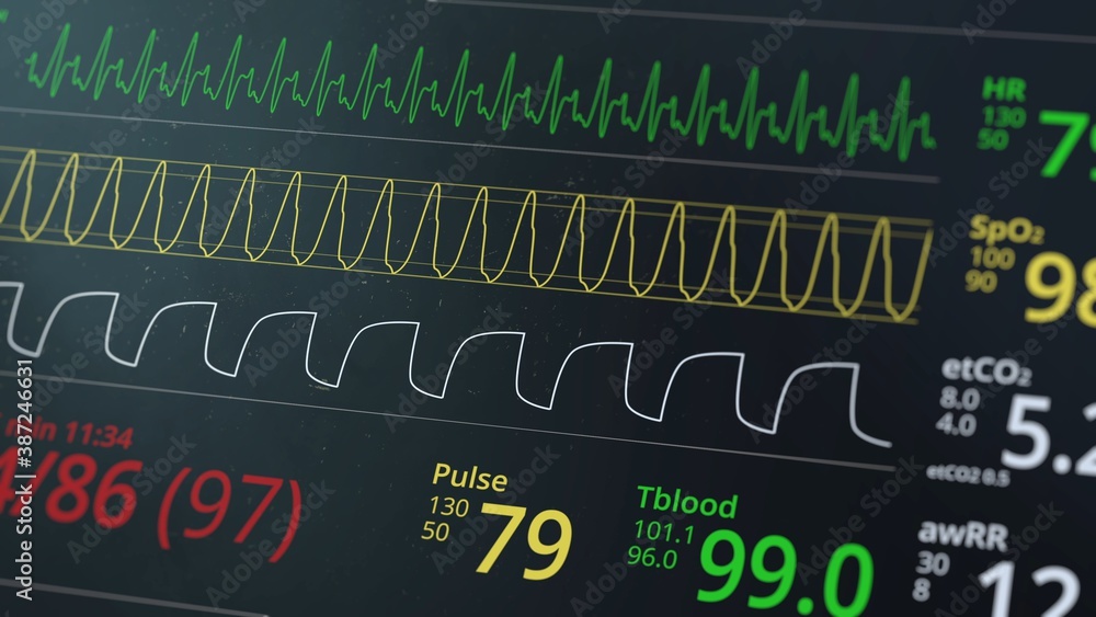 Vital signs of the patient as heart rate, oxygen saturation and ...