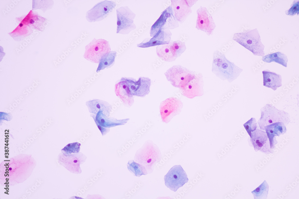 View in microscopic of human skin cells.Squamous epithelium cells ...