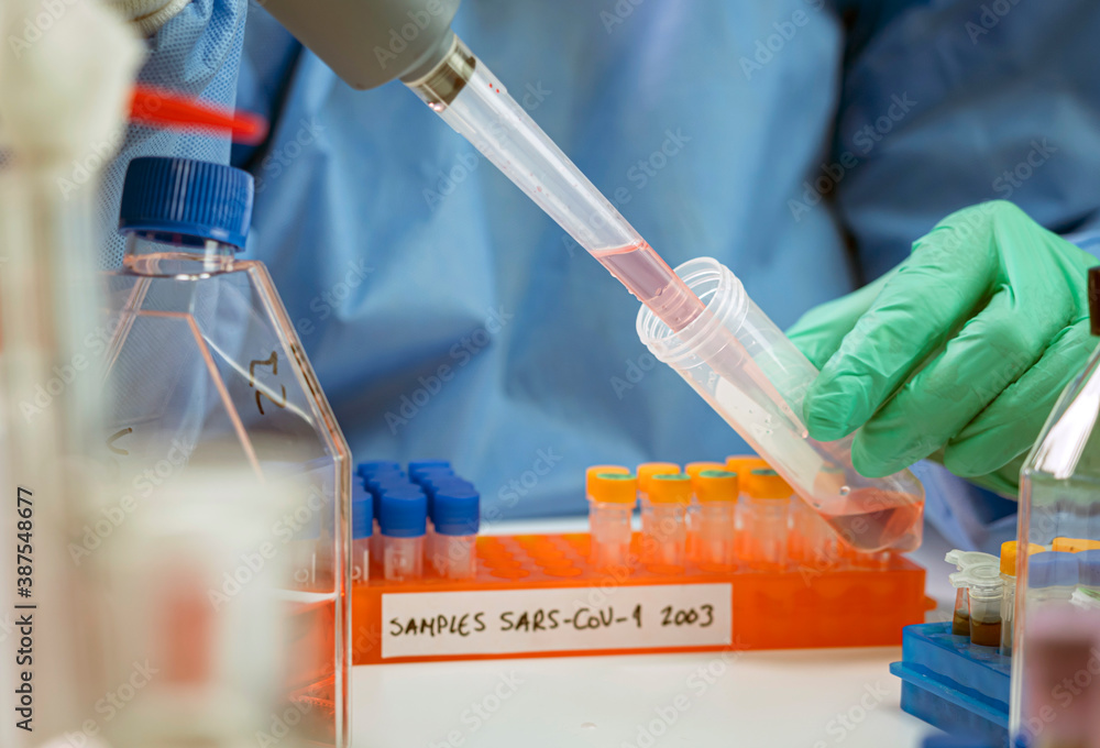 Foto de Vials with samples of SARS-COV-1 prepared cold in a laboratory, epiedomological study on ...