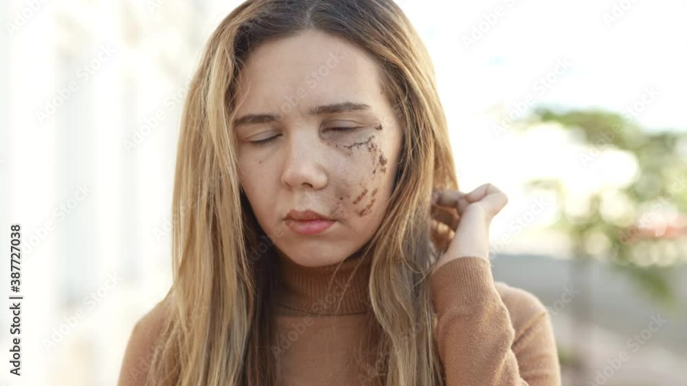 Young woman portrait with scar on her face. Home violence victim ...