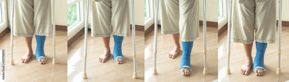 Male patient in splint walking with crutches in hospital, step forward ...