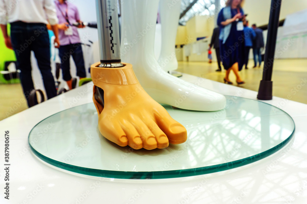 Plastic prosthetic foot. Exhibition of modern prosthetics technologies ...