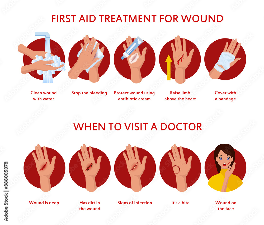 Skin burn. Burned hand treating, protection burns. Bandage on injured ...