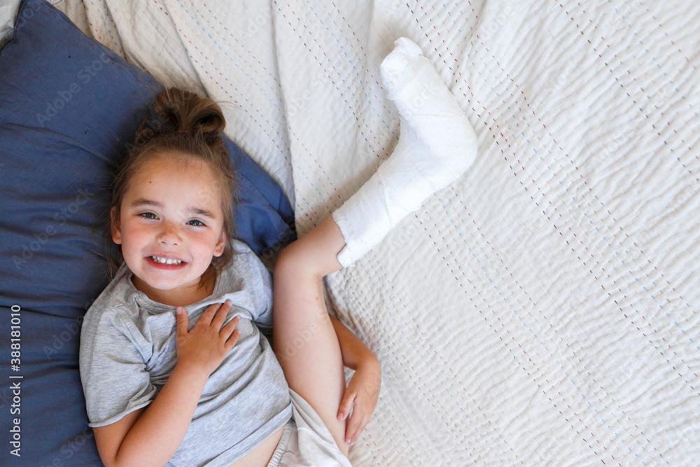 broken leg. Close-up of the cast on the feet. exercises to repair and ...