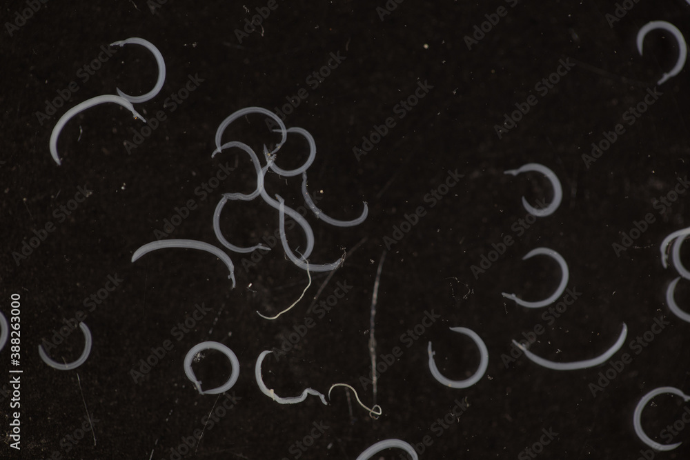 Schistosoma is a genus of trematodes, commonly known as blood flukes ...