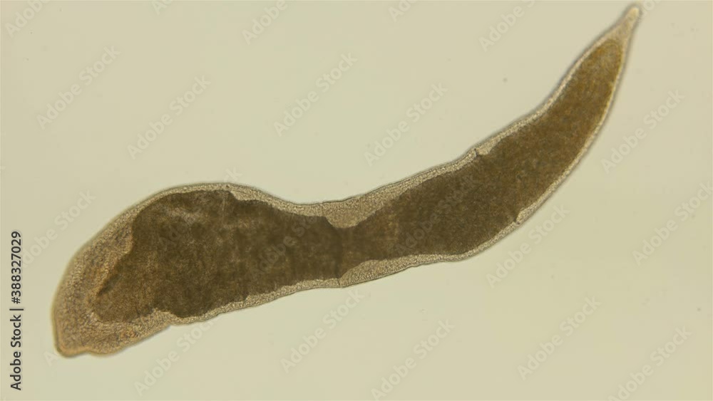 Microstomida worm under a microscope. Order Dolichomicrostomida Sample ...