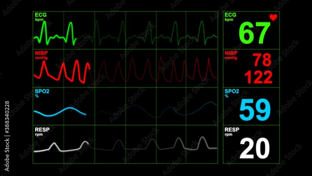 Heart rate monitor in hospital theater. Medical vital signs monitor ...