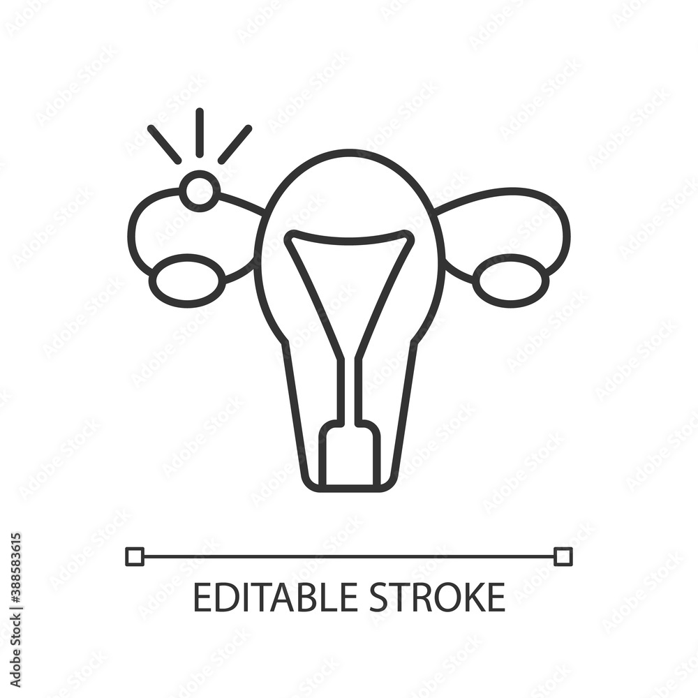 Ectopic pregnancy linear icon. Fallopian tube. Embryo outside uterus ...