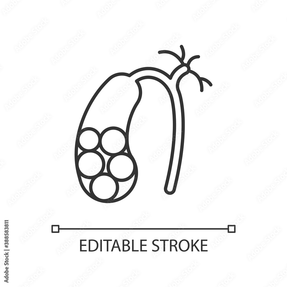 Gallstones linear icon. Cholelithiasis. Hardened bile deposits. Solid ...