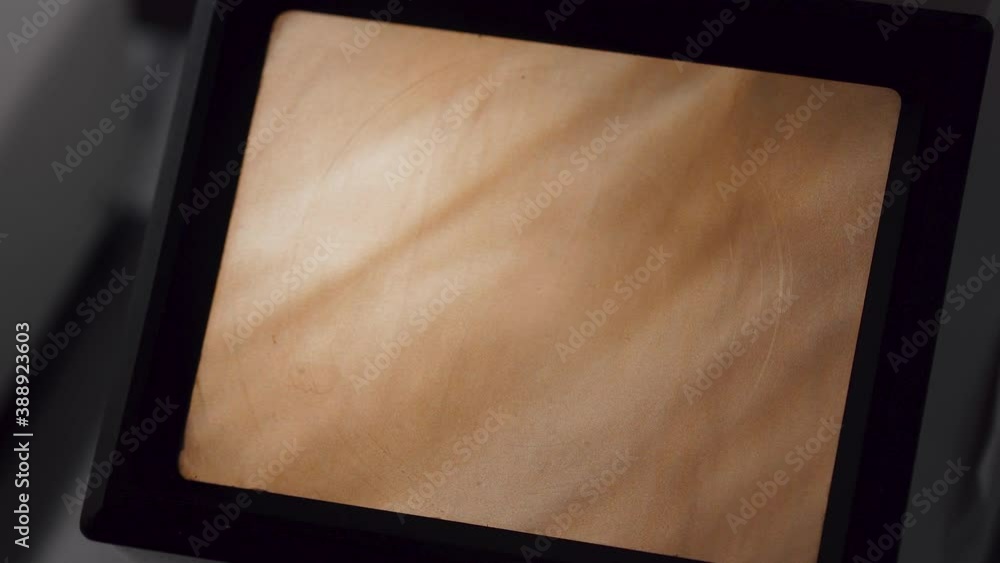 The screen of the microscope. Meat under a microscope. Cell structure ...